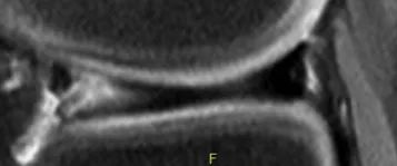 Suggested Collection｜Ultra-detailed MRI anatomy and diagnosis of ...